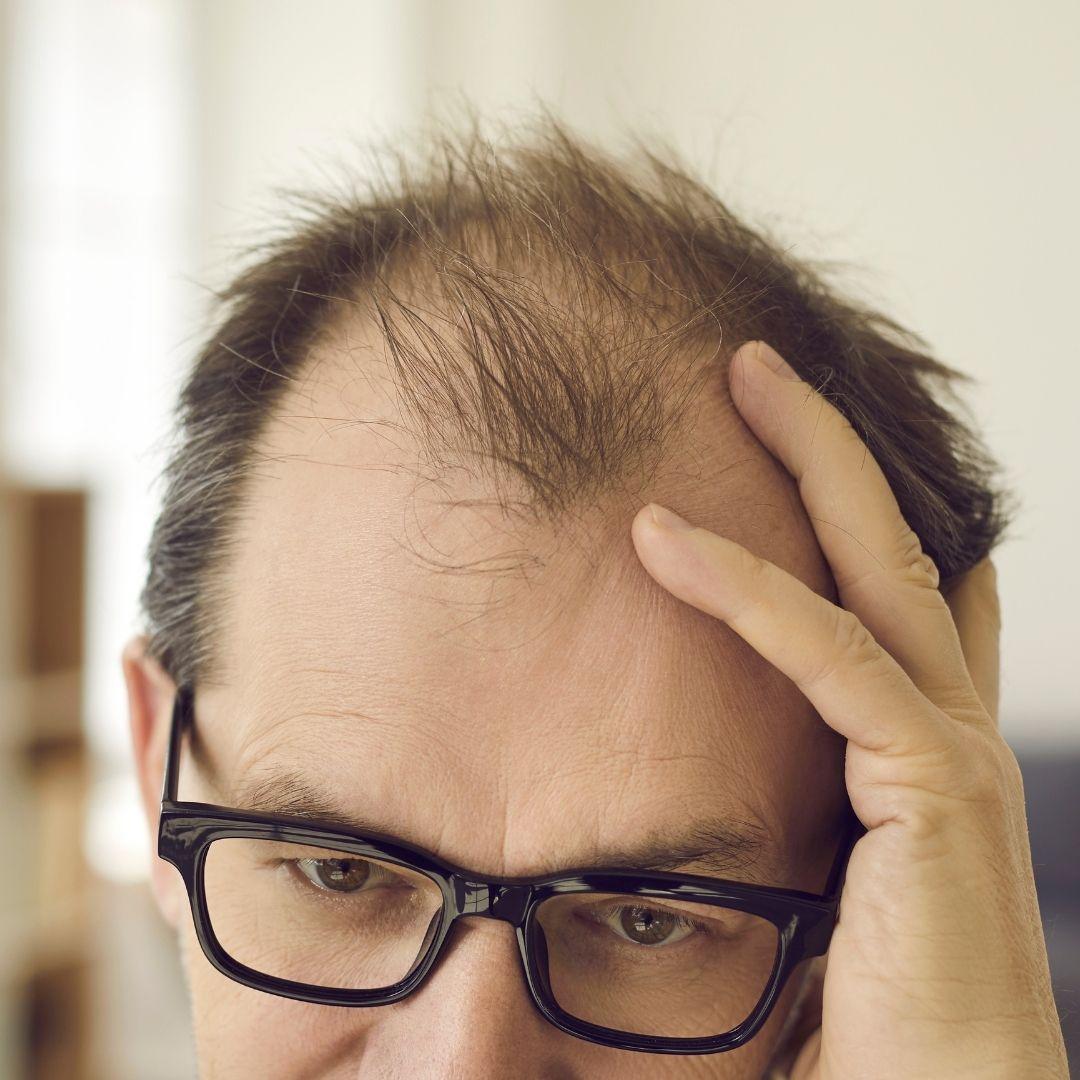 Cosmetic Concerns | Vibra Clinics – Cosmetic Dermatology & Skin Clinic ...