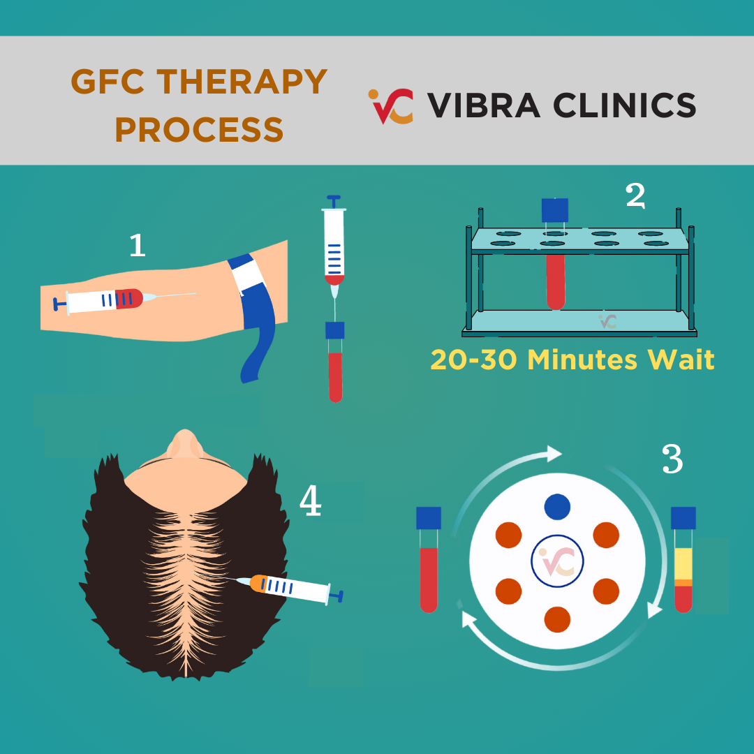 GFC Therapy In Udaipur: Boost Hair Density And Confidence | Vibra Clinics – Cosmetic Dermatology ...